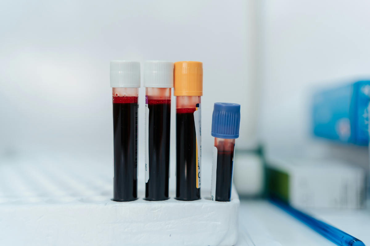 Blood Type by Country 2026