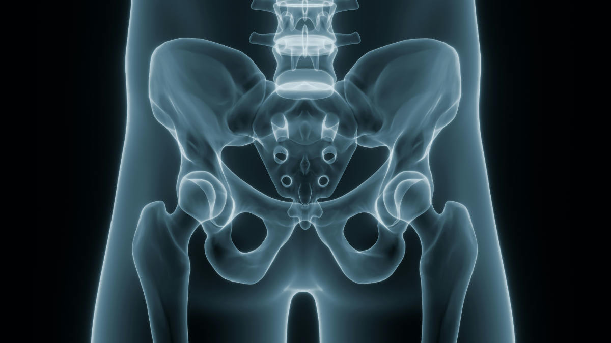 Hip Replacement Cost by Country 2026